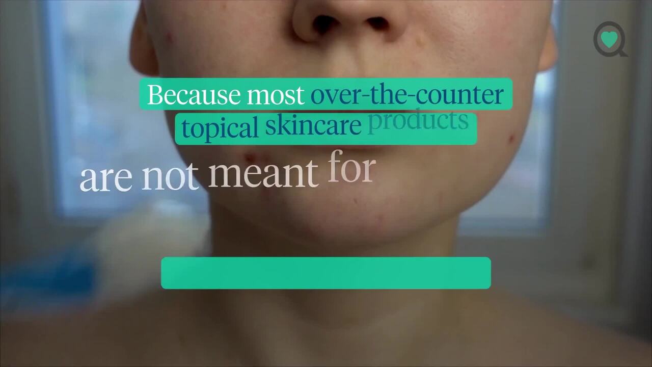 What’s on my skin? 8 common bumps, lumps, and growths | skin-health ...