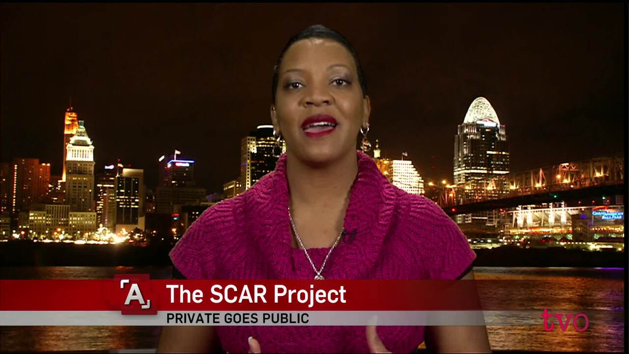 The SCAR Project | TVO Today