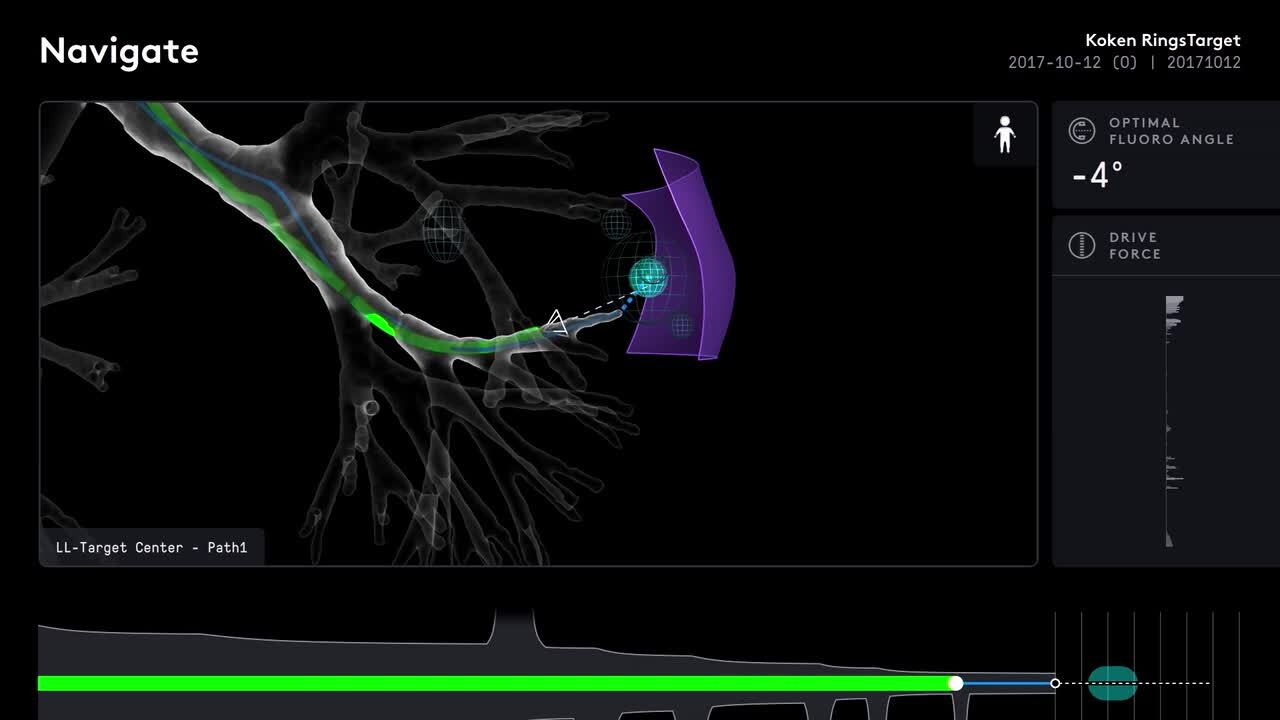 Intuitive | Robotic-Assisted Bronchoscopy | Ion Platform