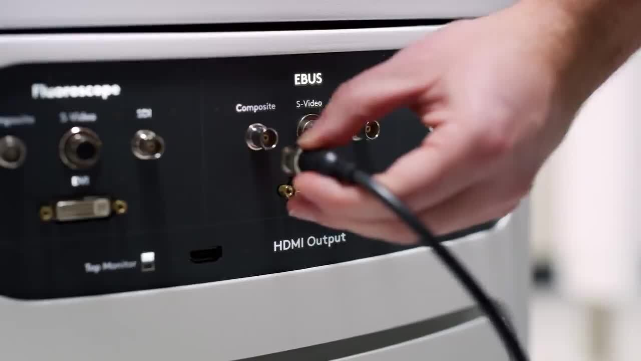 Ion Platform | Robotic-Assisted Bronchoscopy | Intuitive