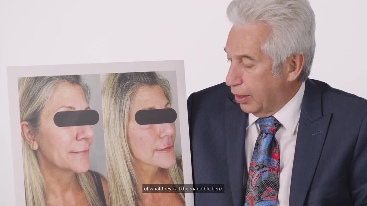 The Dr. Goldfarb Difference - Video - RealSelf