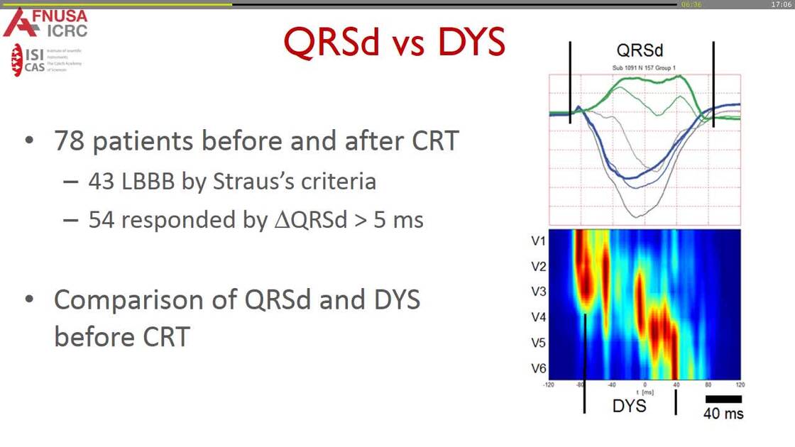 ESC 365 - Electrical dyssynchrony predicts cardiac resynchronization ...
