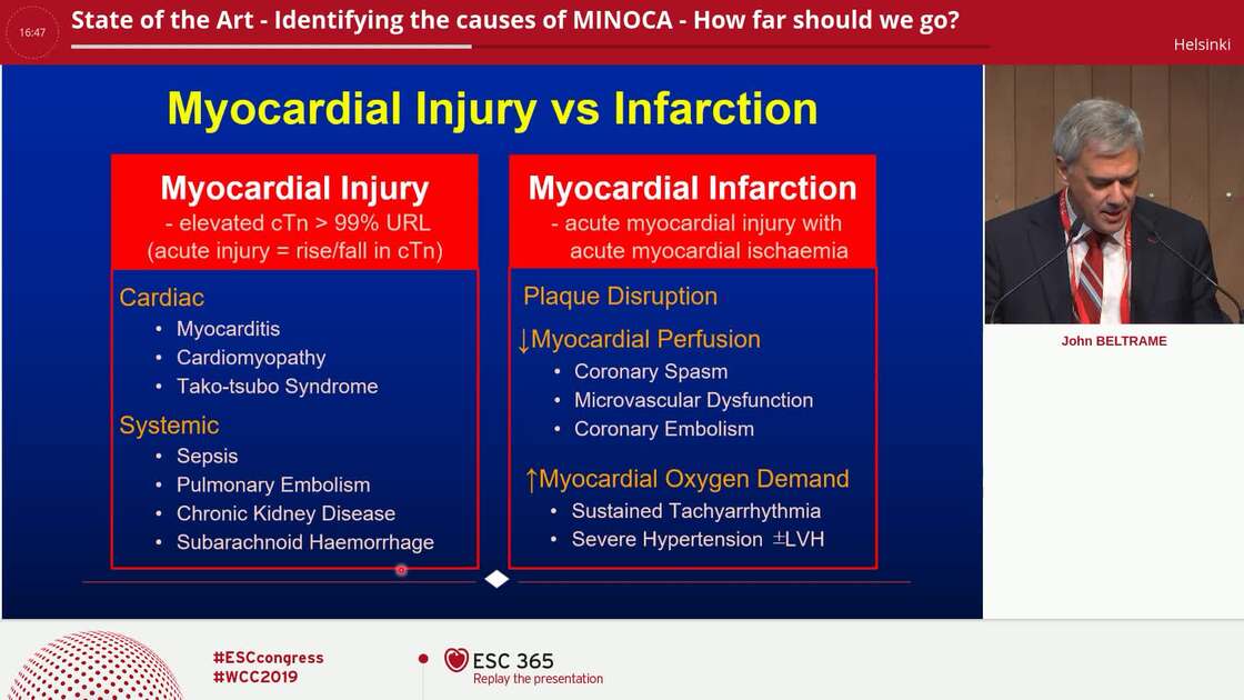 ESC 365 - State of the Art - Identifying the causes of MINOCA - How far ...