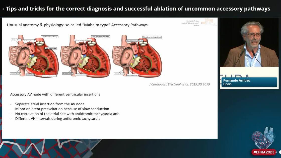 ESC 365 - Tips and tricks for the correct diagnosis and successful ...