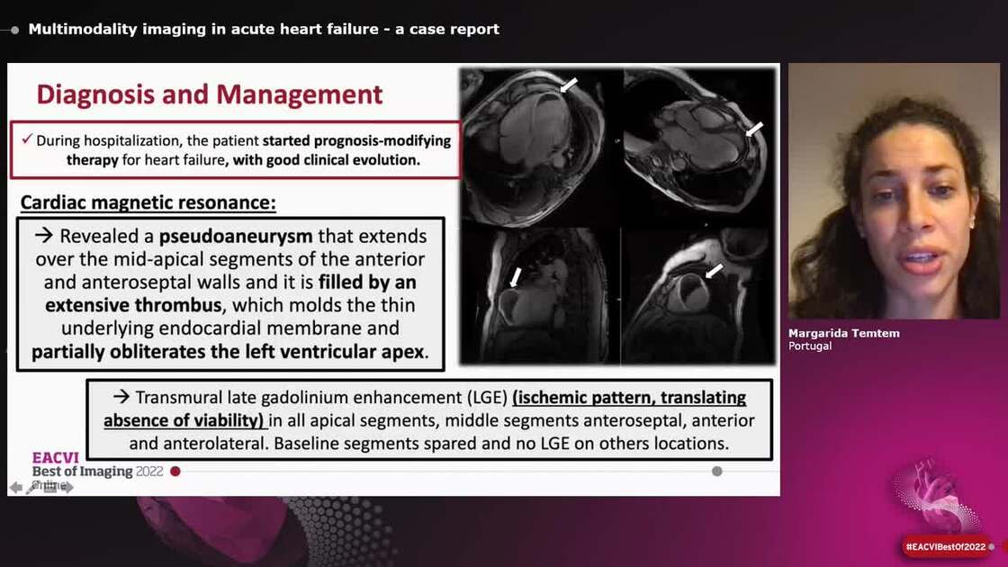 ESC 365 - Multimodality imaging in acute heart failure - a case report