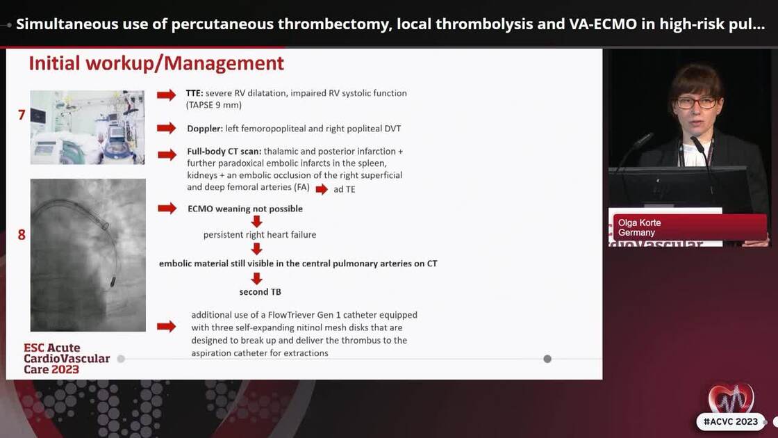 ESC 365 - Simultaneous use of percutaneous thrombectomy, local ...