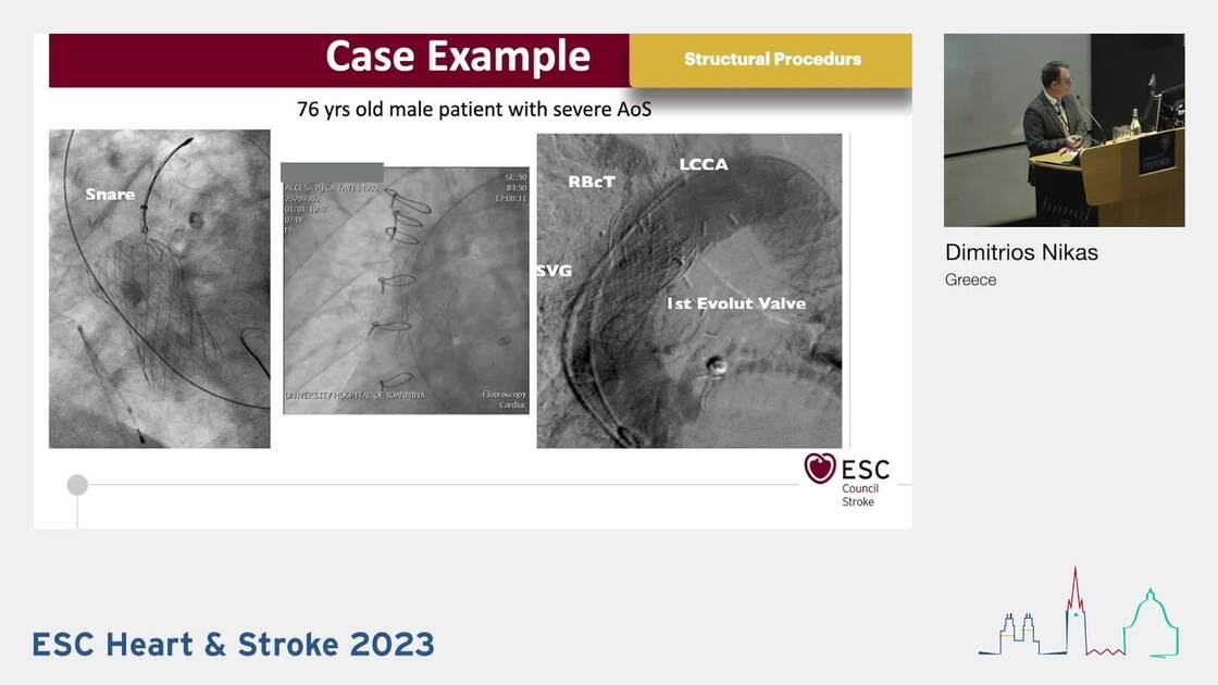 ESC 365 - Role of Specific Procedures and Devices for Preventive Measures