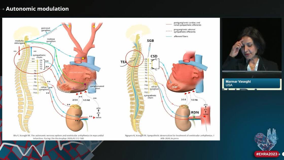 ESC 365 - Autonomic modulation