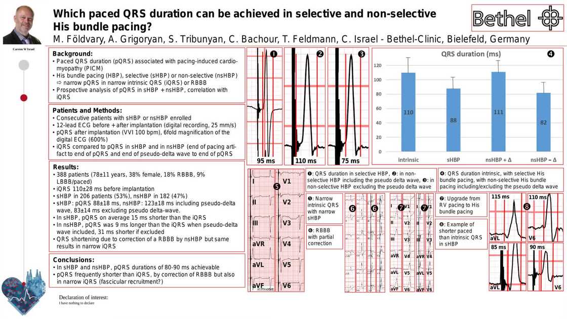 ESC 365 - Which paced QRS duration can be achieved in selective and non ...