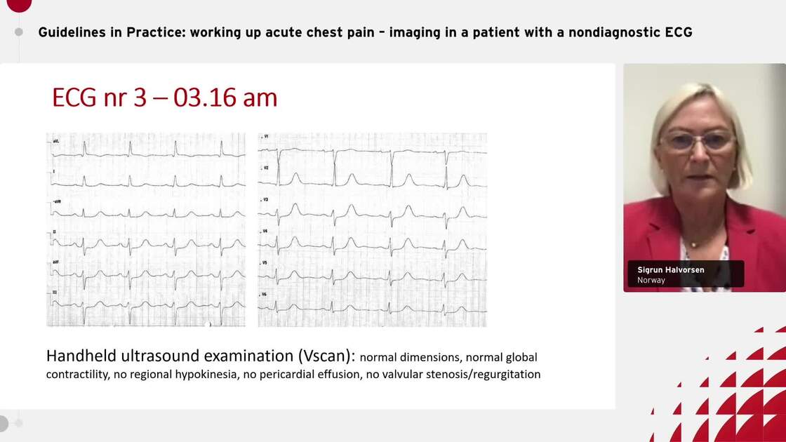ESC 365 - A patient with NSTEMI and a nondiagnostic ECG: case presentation.