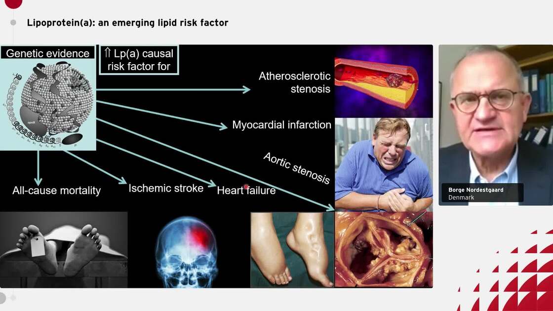 ESC 365 - Lipoprotein(a) and cardiovascular risk.