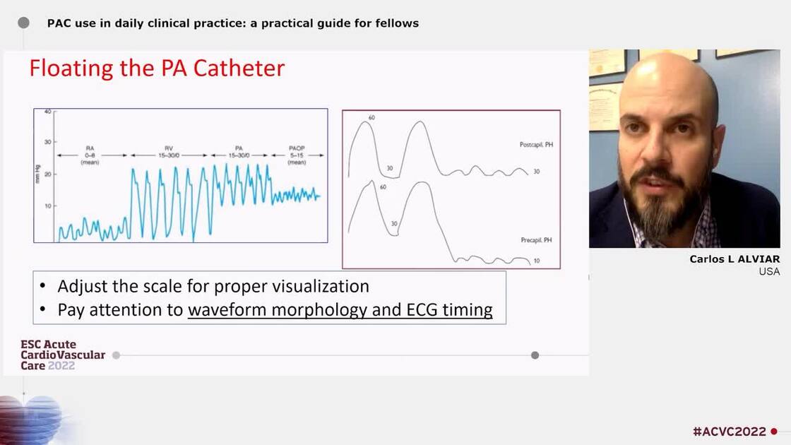 ESC 365 - PAC use in daily clinical practice: a practical guide for fellows