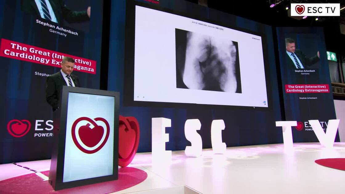 ESC 365 - The Great (Interactive) Cardiology Extravaganza - Friday 25 Aug.