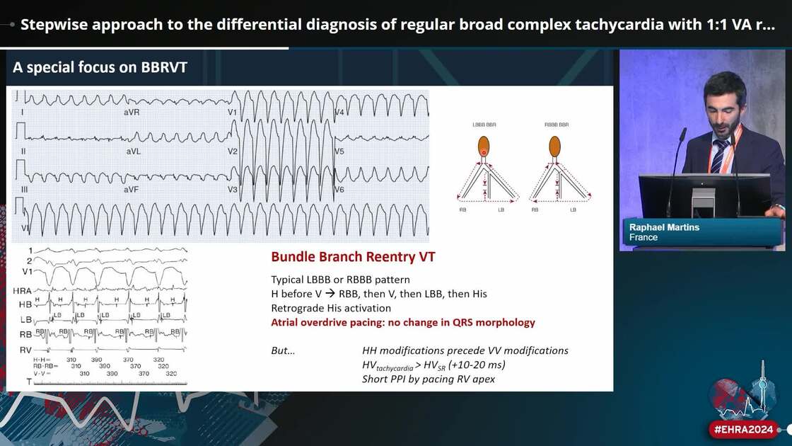 ESC 365 - Stepwise approach to the differential diagnosis of regular ...