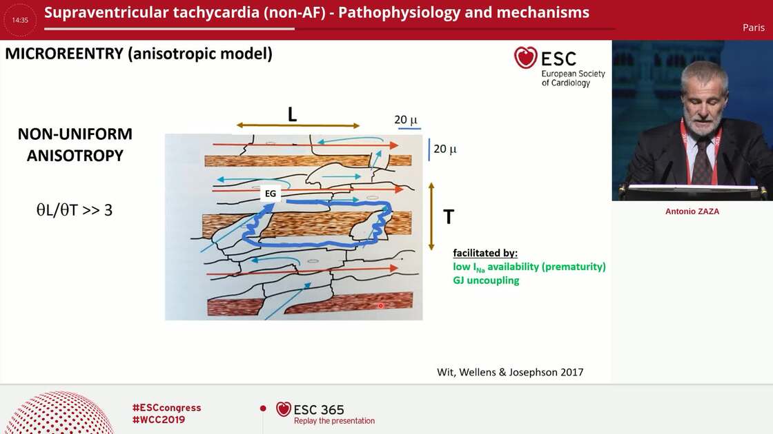 ESC 365 - Supraventricular tachycardia (non-AF) - Pathophysiology and ...