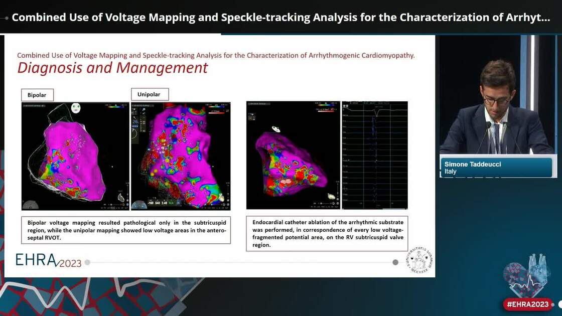 ESC 365 - Combined Use of Voltage Mapping and Speckle-tracking Analysis ...