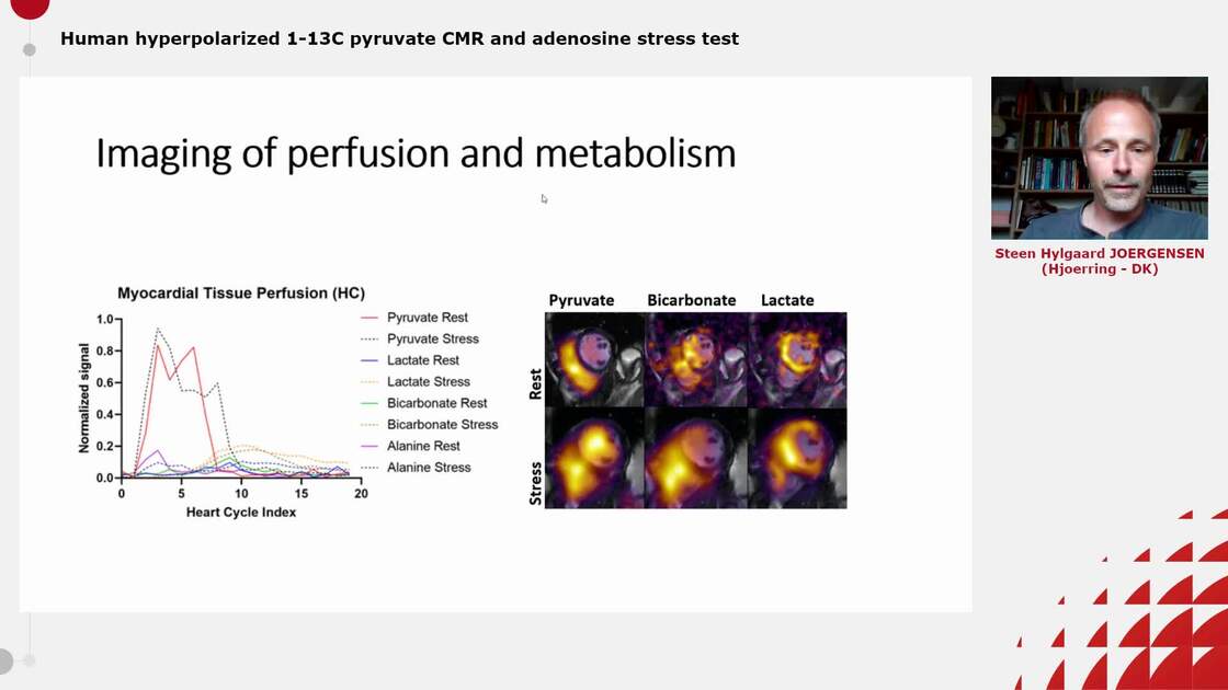 ESC 365 - Human hyperpolarized 1-13C pyruvate CMR and adenosine stress test