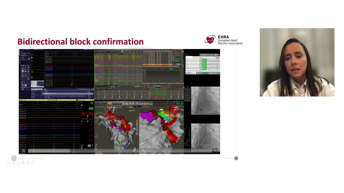 ESC 365 - Optimising atrial arrhythmia ablation: how HPSD has ...