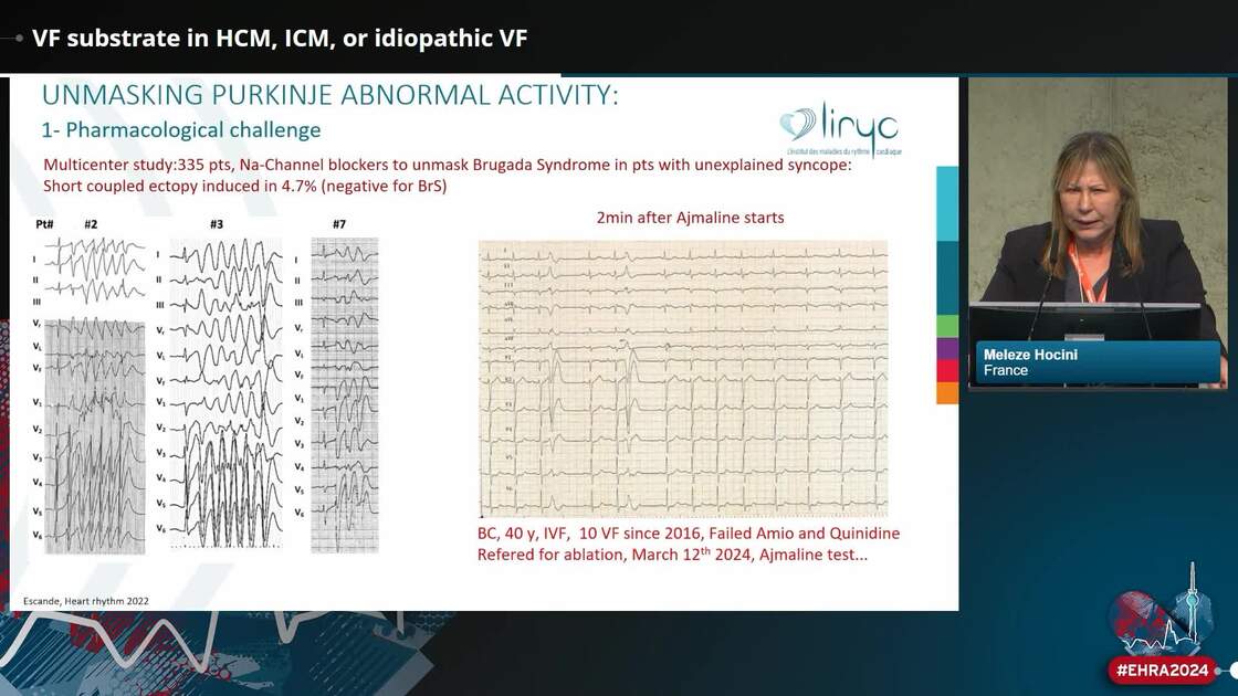 ESC 365 - VF substrate in HCM, ICM, or idiopathic VF