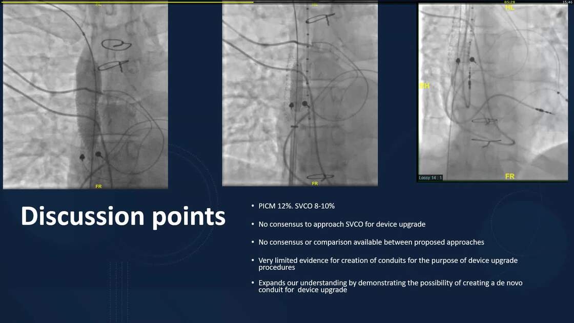 ESC 365 - Percutaneous creation of de novo SVC/RA conduit for CRT upgrade