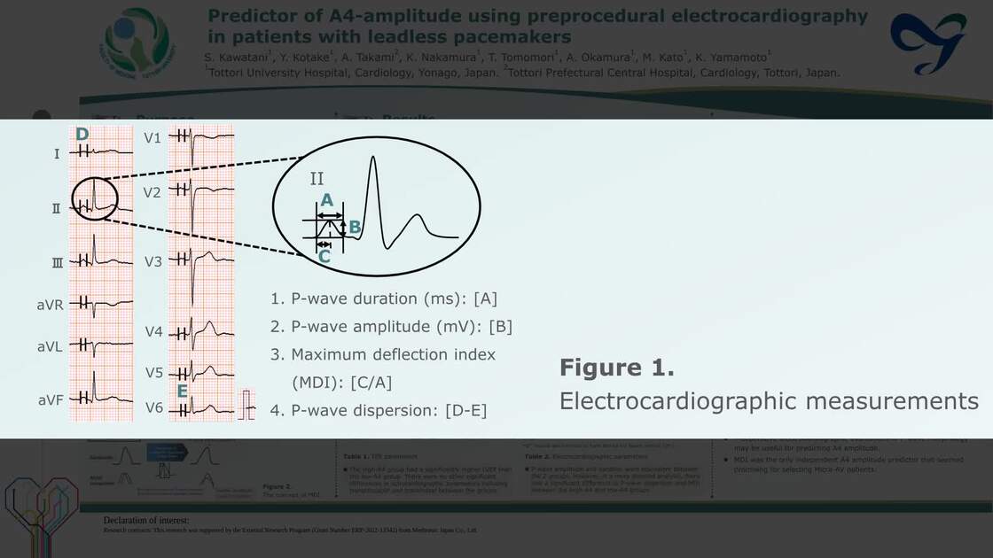 ESC 365 - Predictor of A4-amplitude using preprocedural ...