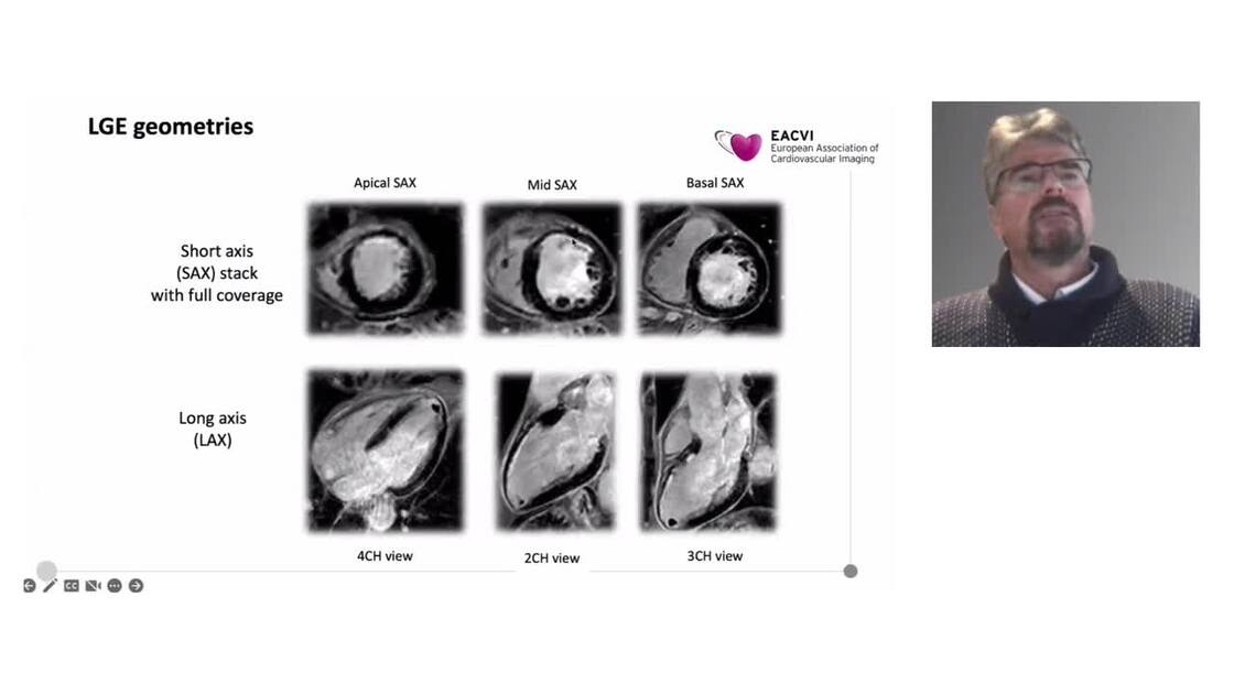 ESC 365 - Myocardial viability: how to use the different imaging modalities