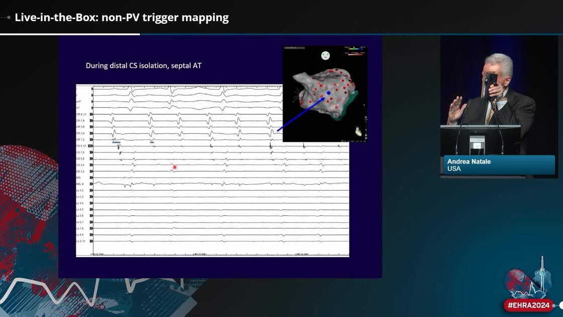 ESC 365 - Live-in-the-Box: non-PV trigger mapping