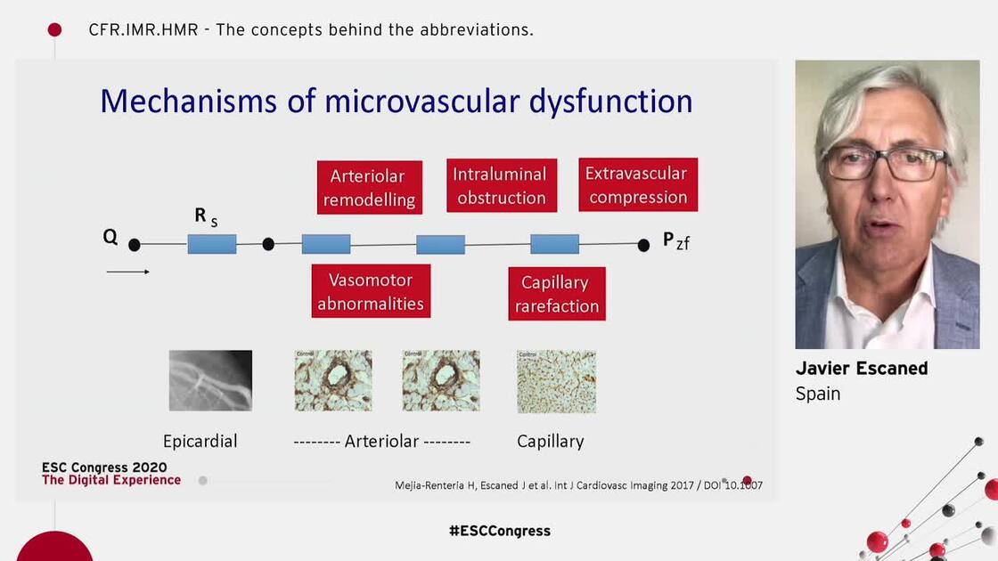 ESC 365 - CFR.IMR.HMR - The concepts behind the abbreviations.