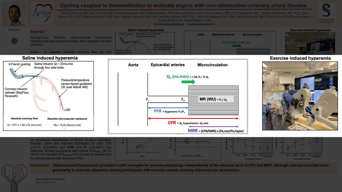 ESC 365 - Cycling coupled to intra-coronary thermodilution to evaluate angina with non ...