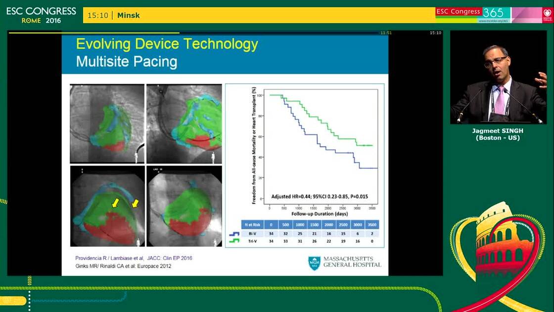 ESC 365 - Role of device technologies and algorithms