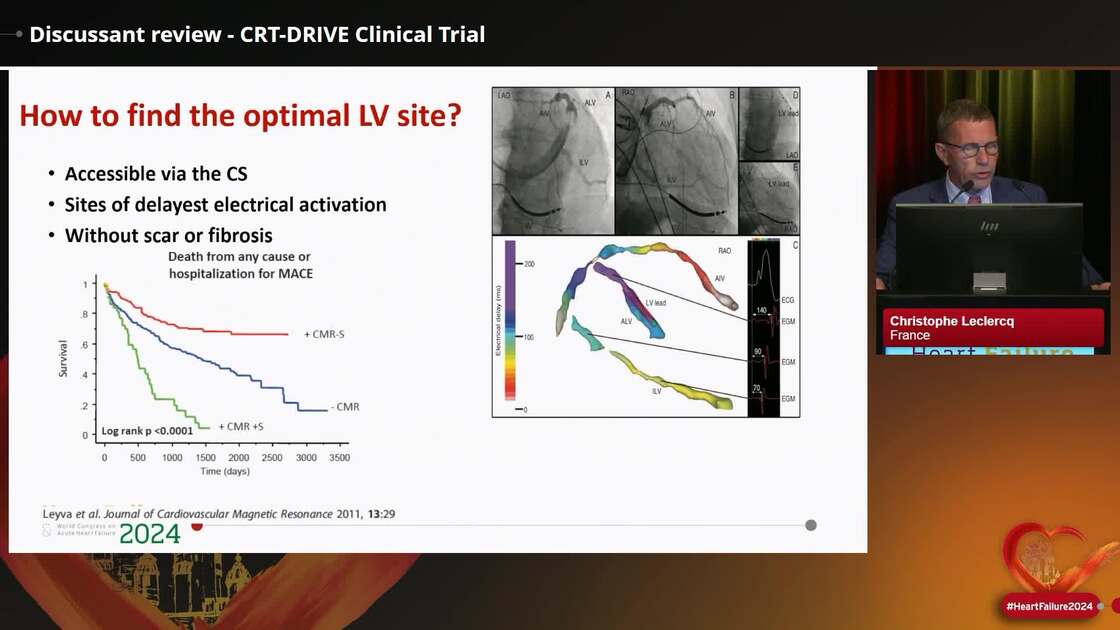 ESC 365 - Discussant review - CRT-DRIVE Clinical Trial
