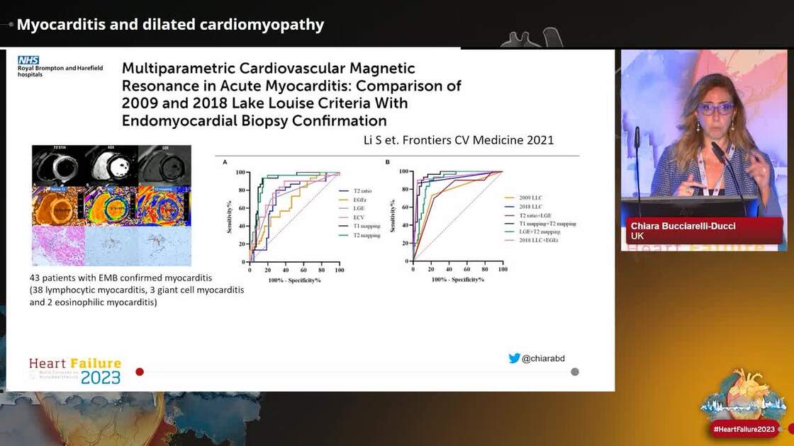 ESC 365 - Myocarditis and dilated cardiomyopathy