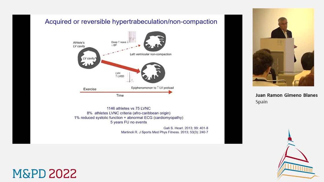 ESC 365 - Hypertrabeculation: look beyond the net