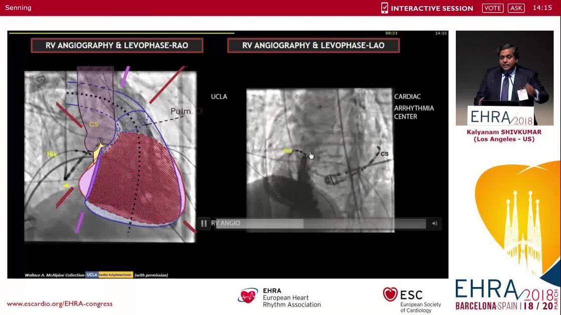 ESC 365 - Anatomy of the left and right ventricles