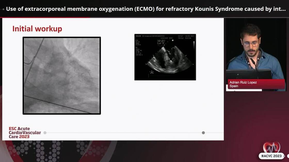ESC 365 - Use of extracorporeal membrane oxygenation (ECMO) for ...