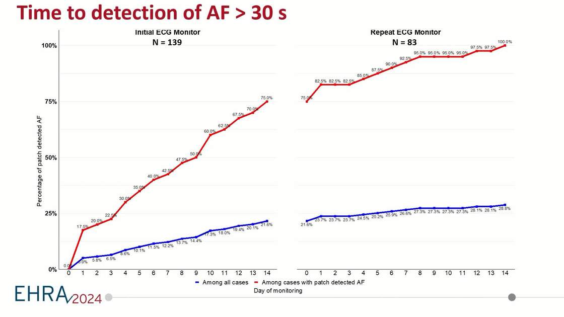 ESC 365 - Timing of detection of atrial fibrillation recurrence in ...