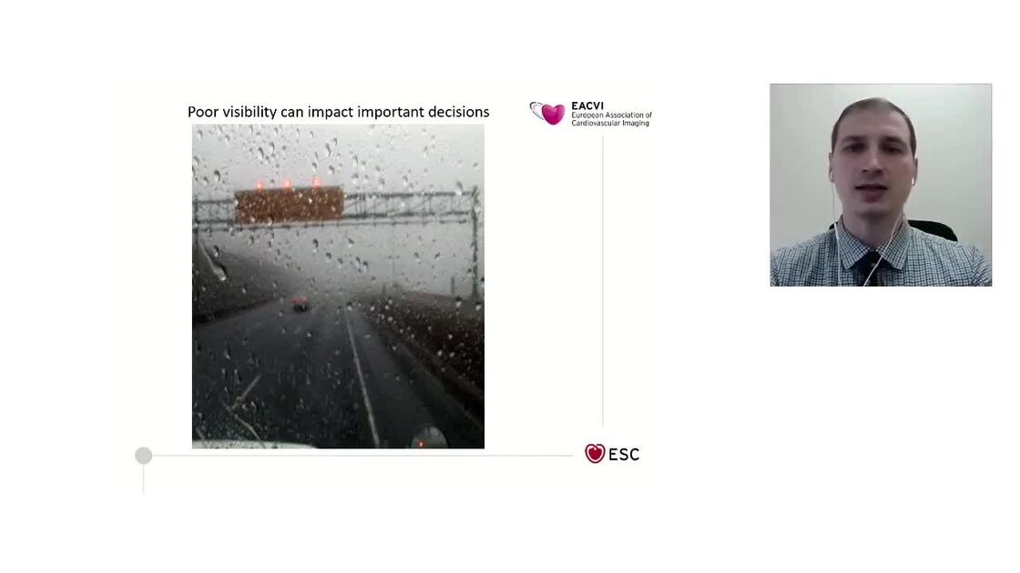 ESC 365 - Stress echo and contrast echocardiography in CHD