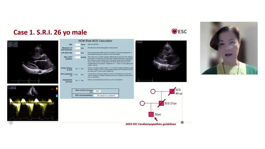 ESC 365 - Sudden cardiac death risk stratification in cardiomyopathies ...