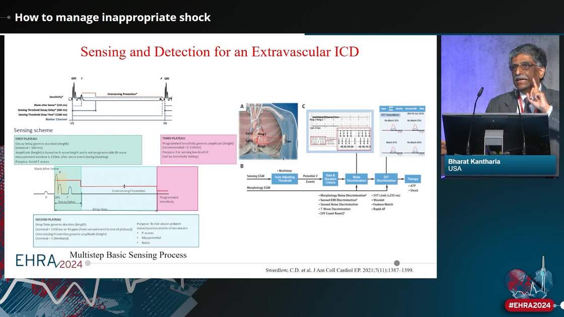 ESC 365 - How to manage inappropriate shock
