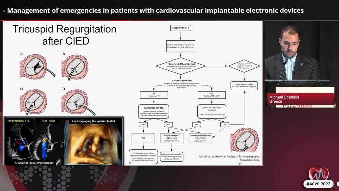 ESC 365 - Management of emergencies in patients with cardiovascular ...