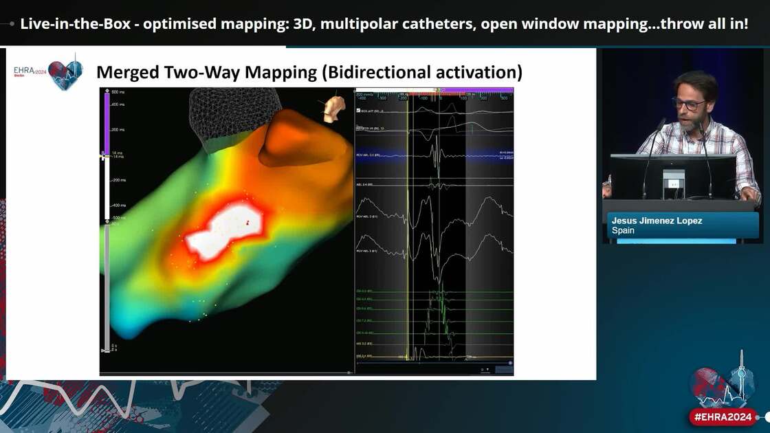 ESC 365 - Live-in-the-Box - optimised mapping: 3D, multipolar catheters ...