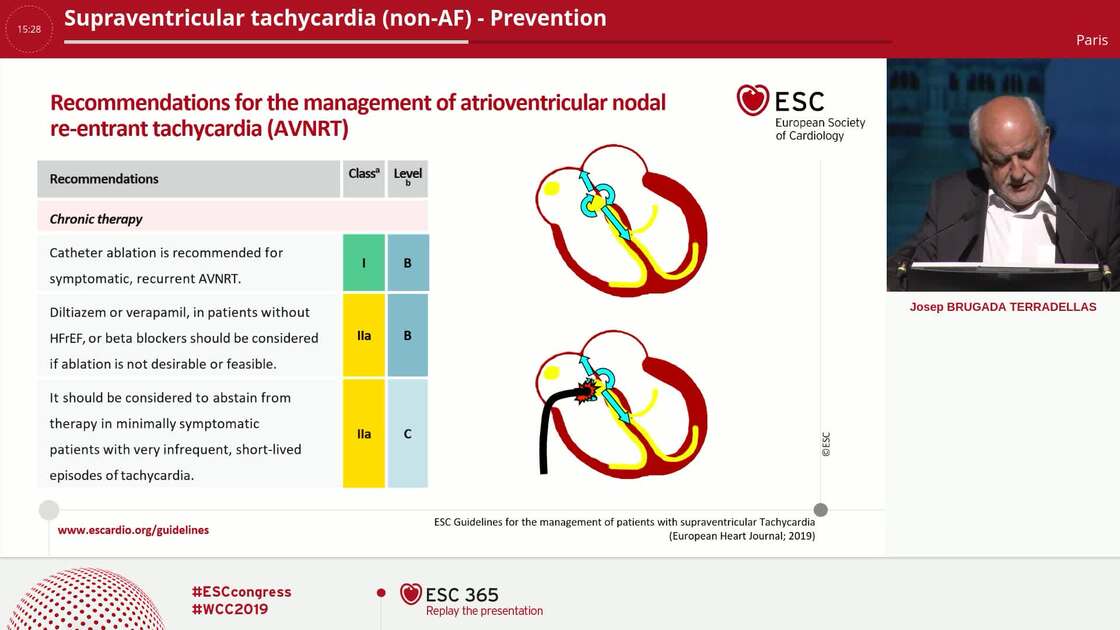 ESC 365 - Supraventricular tachycardia (non-AF) - Prevention