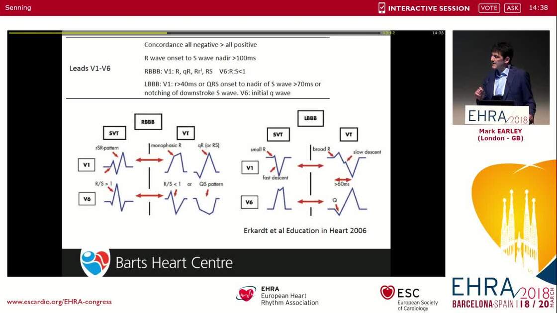 ESC 365 - Differential diagnosis ventricular tachycardia versus SVT ...