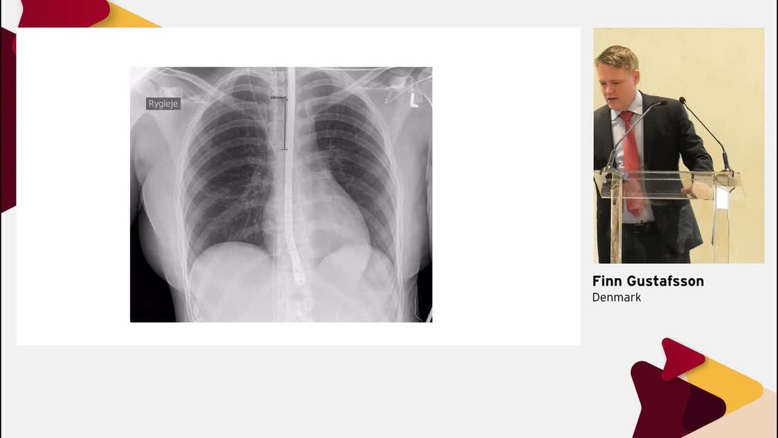 ESC 365 - Short term devices: overview and indications