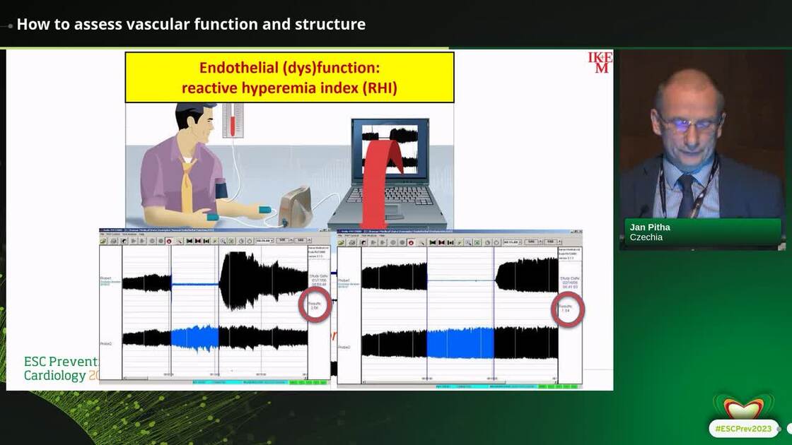 ESC 365 - How to assess vascular function and structure