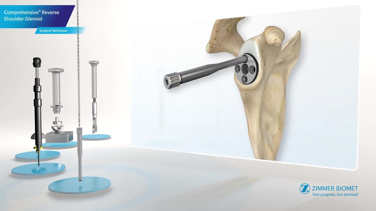 Mini Humeral Tray | Zimmer Biomet | Zimmer Biomet