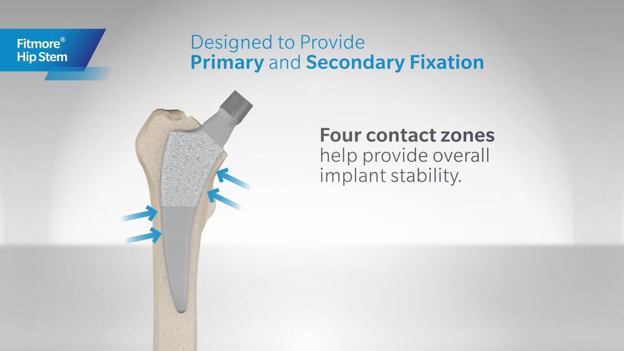 Fitmore Hip Stem | Zimmer Biomet | Zimmer Biomet