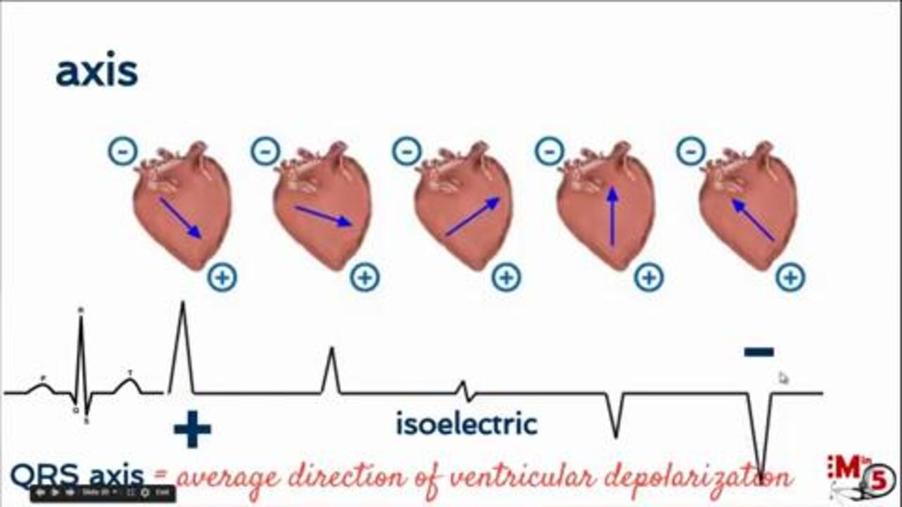 Video: EKG interpretation training review