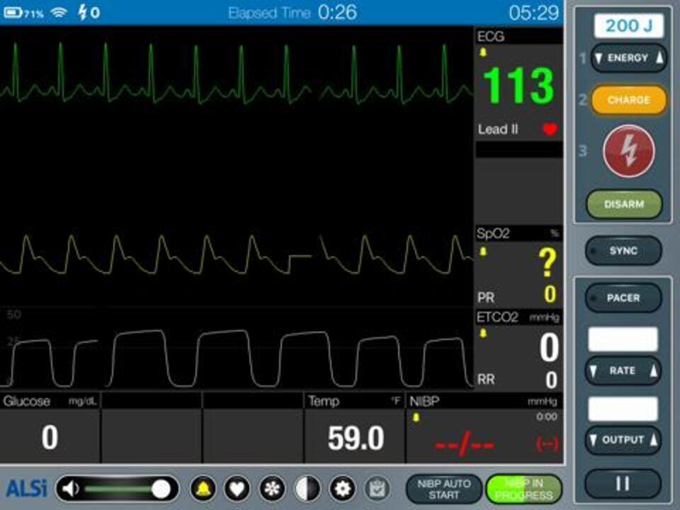 Video: Simulated patient monitor video