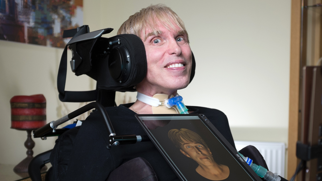 Peter: The Human Cyborg | TVO Today